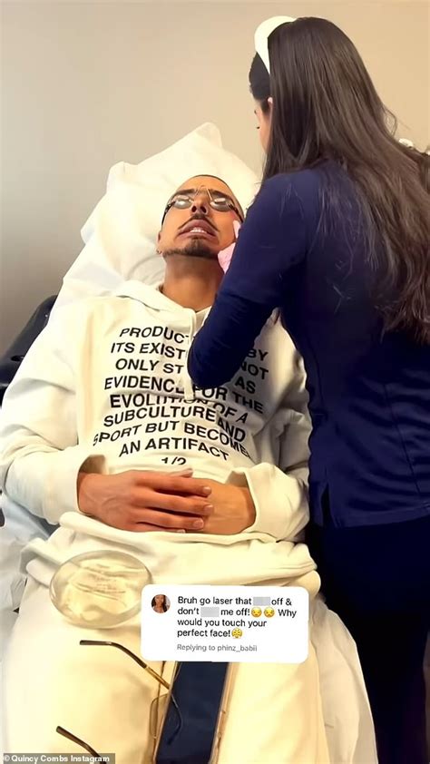 Diddys Stepson Quincy Brown Removes Perfect Face Tattoo After