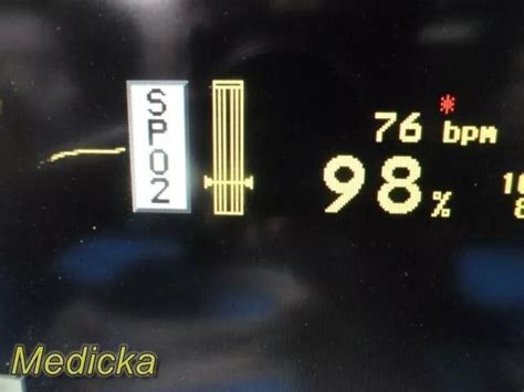 Used Spacelabs 90309 Vital Signs Patient Monitor For Sale Dotmed