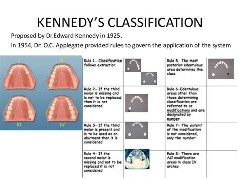 Diagnosis And Treatment Planning For Removable Partial Dentures Diagnosis And Treatment Planning For Removable Partial Dentures