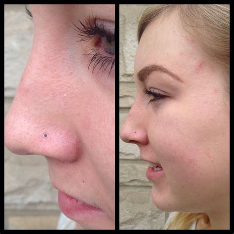 Can You Hide A Septum Piercing Without A Retainer Septum Piercing
