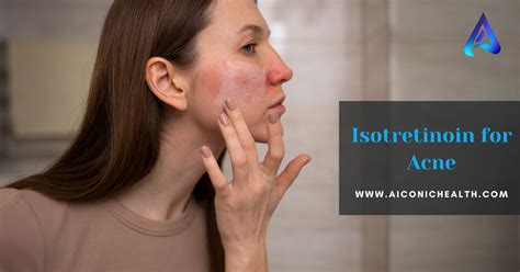 Isotretinoin For Acne Everything You Need To Know