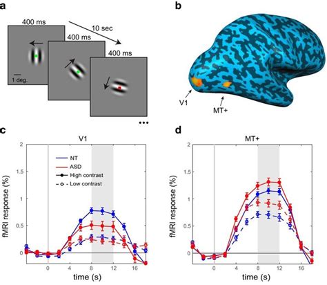 Response Dissociation In Hierarchical Cortical Circuits A Unique Feature Of Autism Spectrum