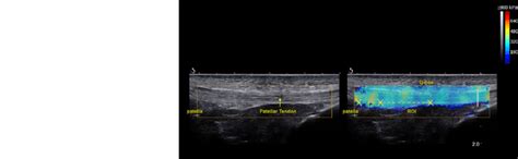 Rectangular Roi With Q Box Tm Tracing Dashed Area Defined Between 5 Download Scientific