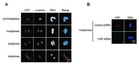 Ctip Is Associated With Spindles During Mitosis A Hela Cells