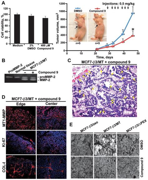 Novel Mt1 Mmp Small Molecule Inhibitors Based On Insights Into