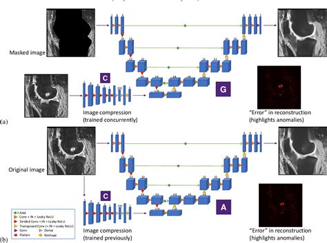 Figure 3 From Automated Anomaly Aware 3D Segmentation Of Bones And