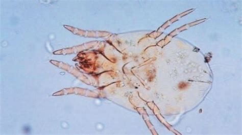 Scientists Find Deadly Scrub Typhus Bacteria In South America Scientist South America America