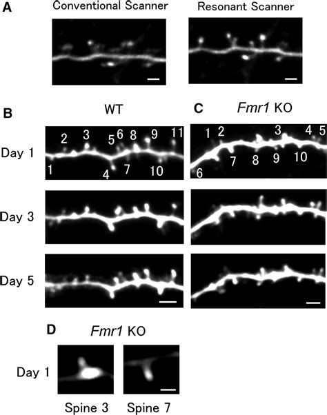 In Vivo Volume Dynamics Of Dendritic Spines In The Neocortex Of Wild Type And Fmr1 Ko Mice Eneuro