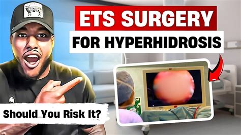 Surgery For Hyperhidrosis Endoscopic Thoracic Sympathectomy Ets