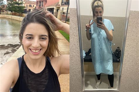 Multiple Sclerosis How MS Affected My Eyesight