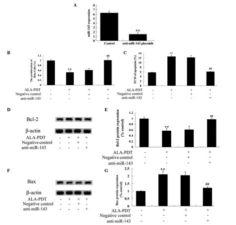 5 Aminolevulinic Acid Photodynamic Therapy In Human Cervical Cancer Via