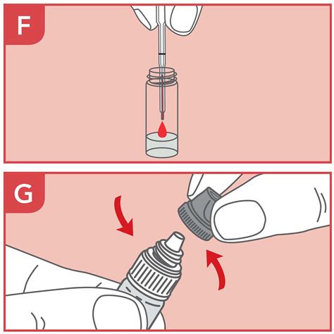 Hiv Luas Diagnostics