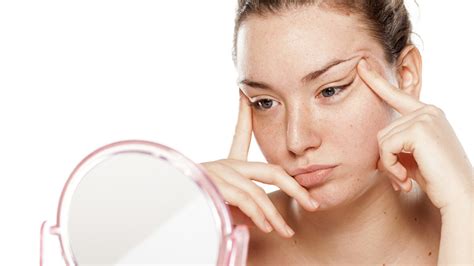 Dr Roullé Chirurgie esthétique Reims Lifting