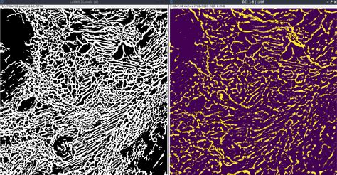 difficult dimple sem image segmentation image analysis image sc forum