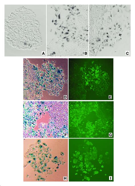 Fbxo31 Ectopic Expression Induces Cellular Senescence In Mcf 7 Cells