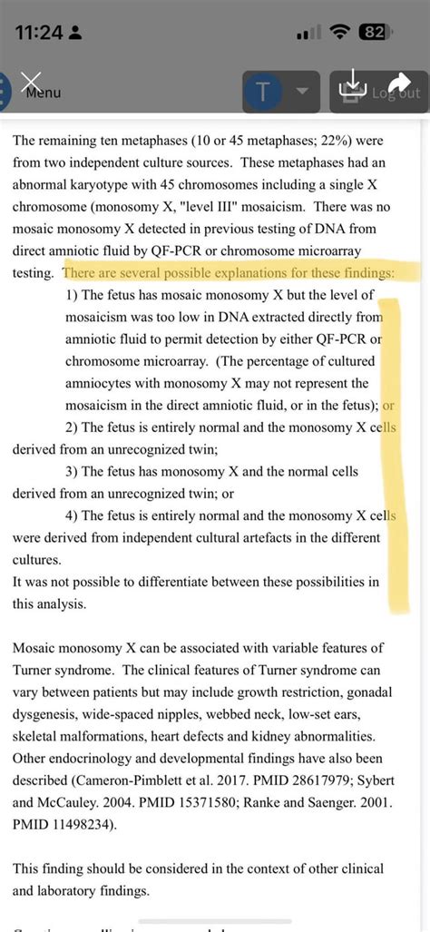 Monosomy X Mosaic Results Rnipt