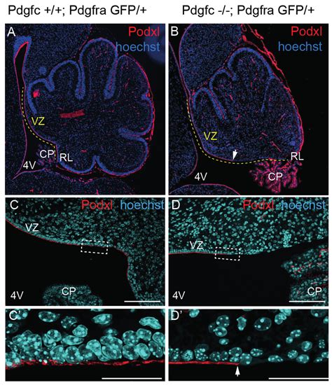 Lost Integrity Of Ependymal Cells Immunofluorescent Staining Of