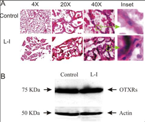 Figure 1 From Pulsatile But Not Tonic Secretion Of Oxytocin Plays The Role Of Anti Precancerous