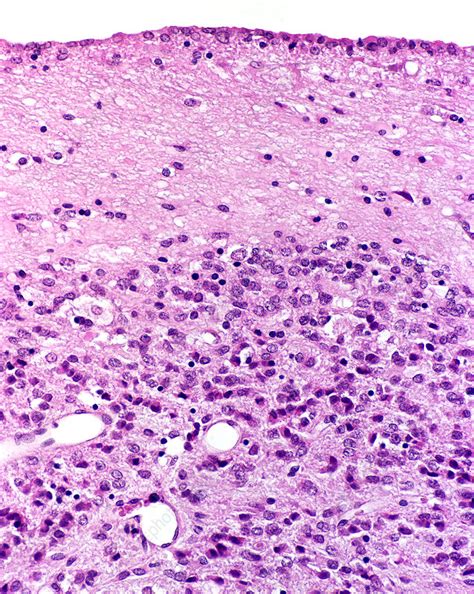 Pineal Gland Stock Image P7500141 Science Photo Library