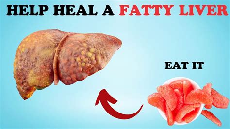 6 Superfoods That Help Heal A Fatty Liver Healthy Care Youtube