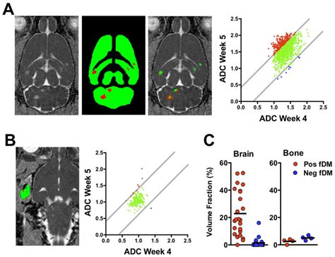 Functional Diffusion Maps FDM Demonstrate The Spatial Changes In