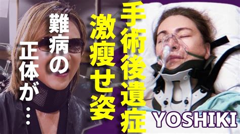 Yoshiki、首の手術後の後遺症に苦しむ Alphatimes