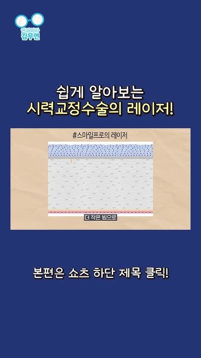 라식 라섹에 사용되는 레이저 원리 Youtube