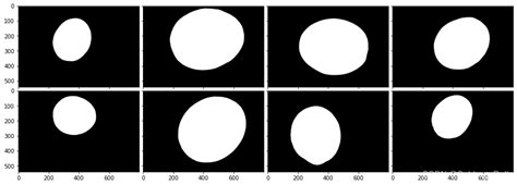 医疗图像切割日记 01 用nnunet做fatal Head Segmentation Challengennunet模型 Csdn博客