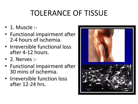 Volkmann¶s Ischemic Contracture Pptx