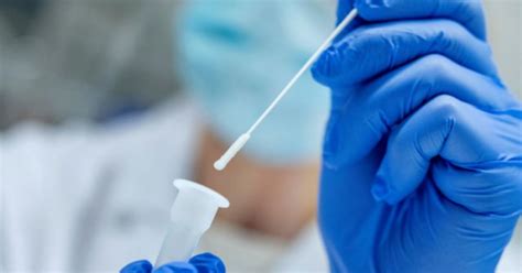 Lack Of Nabl Accredited Food Testing Labs Haunt Dakshina Kannada Udupi