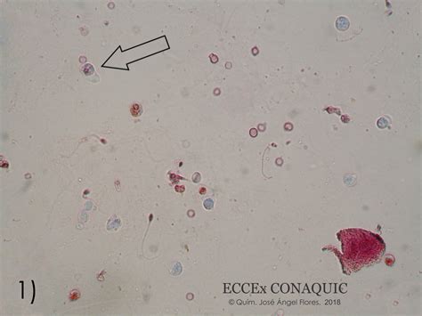 Examen General De Orina Enero 2018