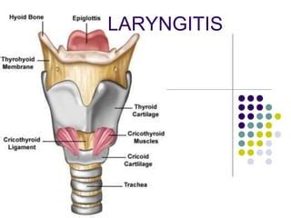 Laryngitis Ppt