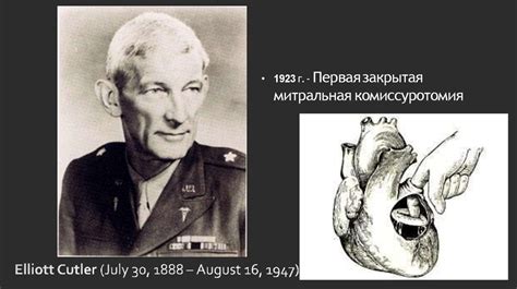 Основы кардиохирургии - презентация онлайн