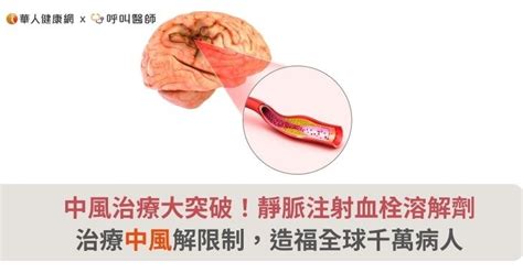 中風治療大突破！靜脈注射血栓溶解劑治療中風解限制，造福全球千萬病人 華人健康網 專業即時優質的健康新聞及資訊分享平台業即時優質的健康