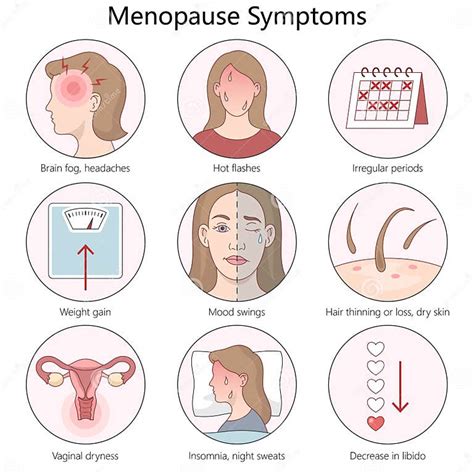 Common Menopause Symptoms Illustrated Science Stock Vector