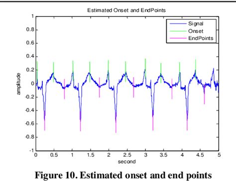 Figure 1 From Detection Of Peak And Boundaries Of P And T Waves In Ecg Signals Semantic Scholar