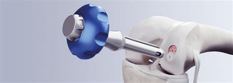 Amic Arthroscopic Instruments Geistlich Pharma Ag