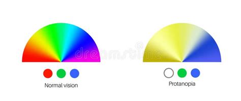 Protanomaly And Protanopia Stock Vector Illustration Of Vision 307074935