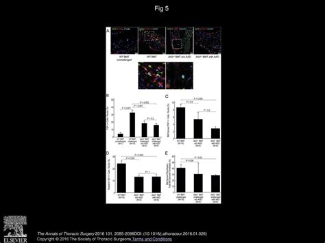 Akt2 Promotes Bone Marrow Cell Mediated Aortic Protection In Mice Ppt