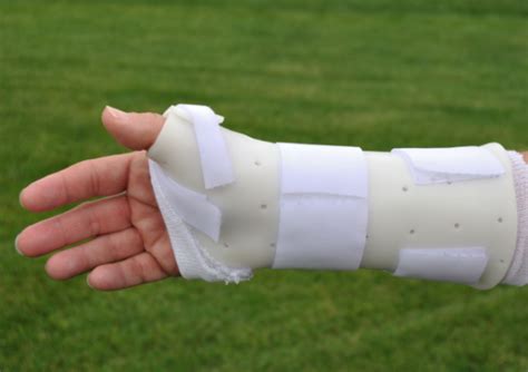 Buckle Fracture Overview Buckle Fracture Treatment Louisville Ky