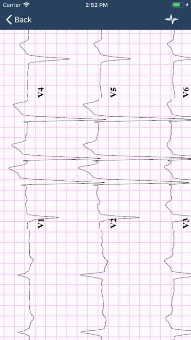 Ecg Guide Ios Free Download Without Jailbreak Panda Helper