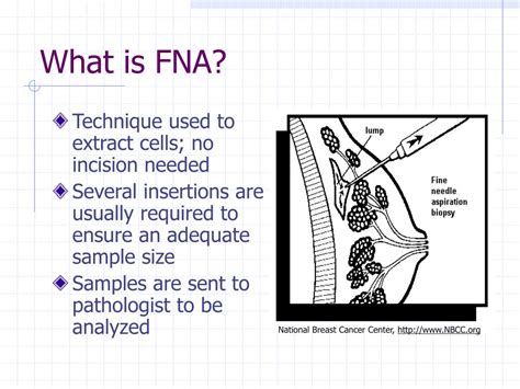 Ppt Improved Fine Needle Aspiration Biopsy Powerpoint Presentation Free Download Id 1038853
