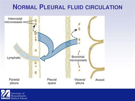 Ppt Management Of Pleural Effusions Hueh 2011 Terry Flotte Md