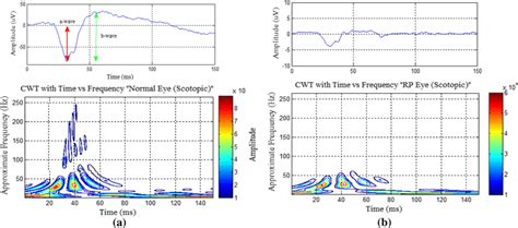 Contour Plot Generated By The Morlet Based Cwt A A Normal Sample Download Scientific Diagram