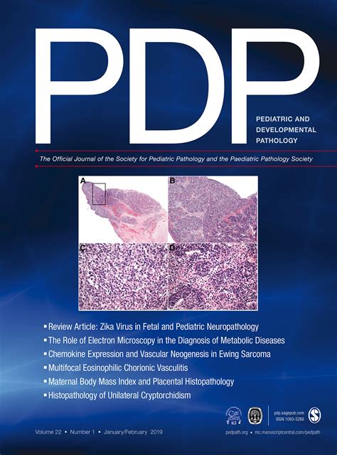 Ovotesticular Disorder Of Sex Development Ovotestis In Simpson Golabi Behmel Syndrome