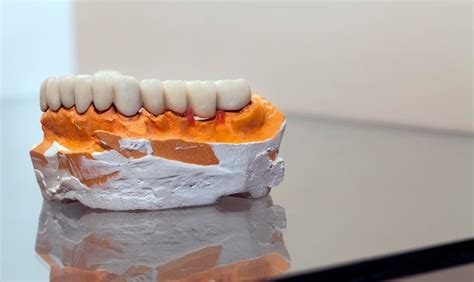 Placa De Dientes De Porcelana De Circonio En Foto De Tienda De Dentista