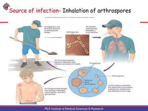 Systemic Mycosis Pptx