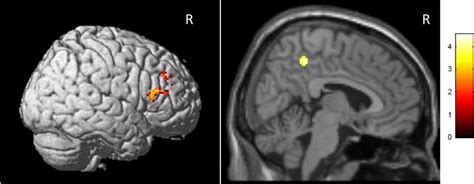 Higher Working Memory Related Functional Mri Activation Download