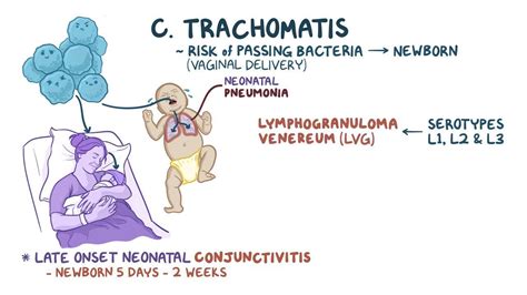 Video Chlamydia Trachomatis Osmosis