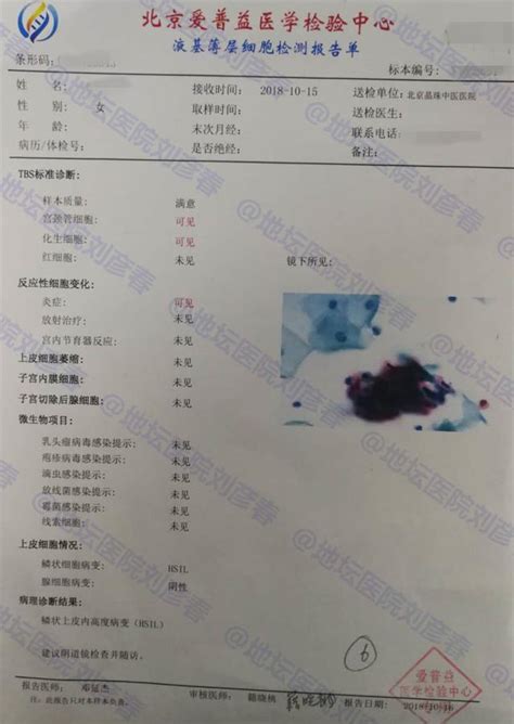 病例分享——宫颈上皮内瘤变cin3与宫颈癌的关系 病变